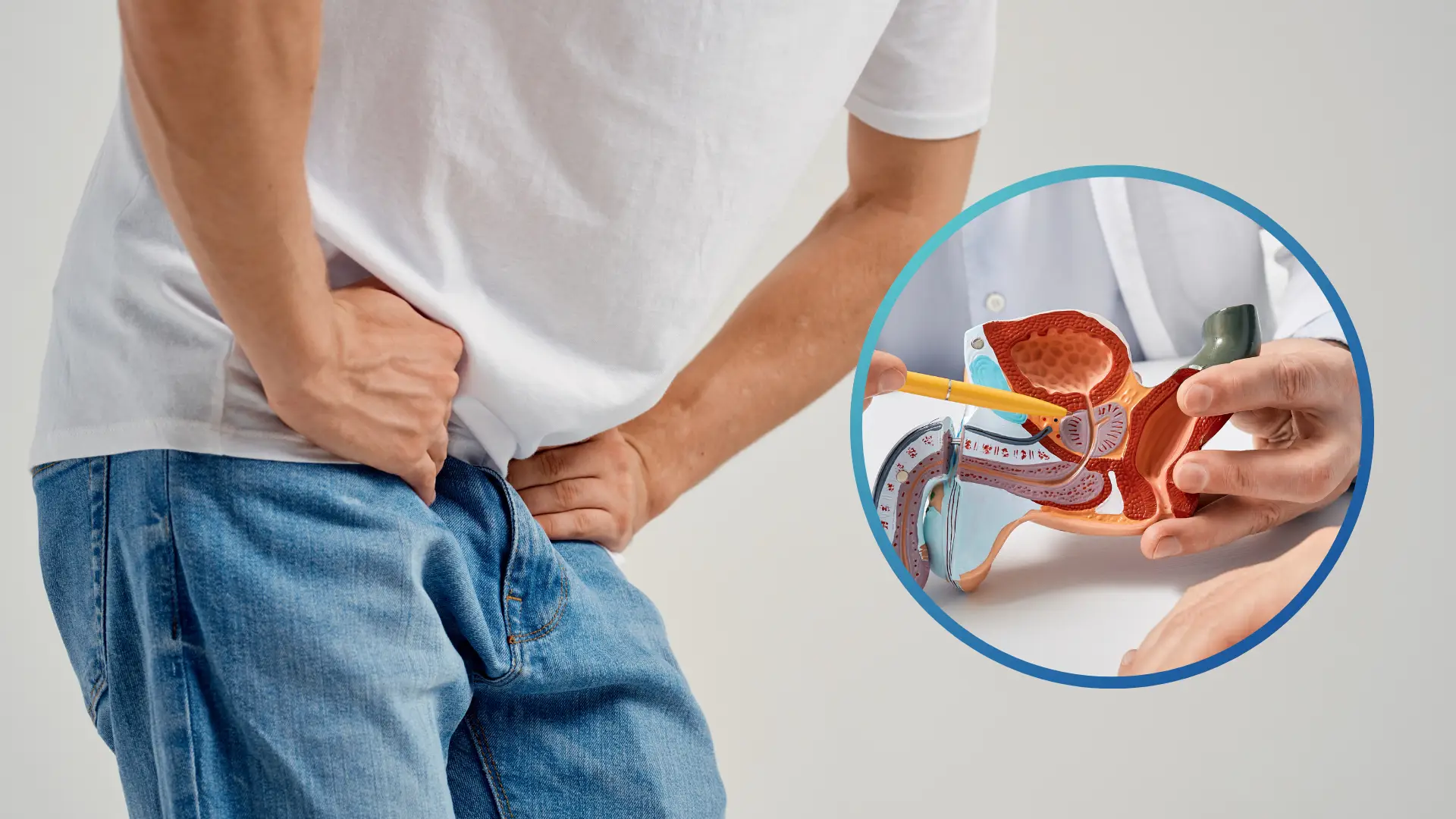 What is benign prostatic hyperplasia? When does it require treatment ...